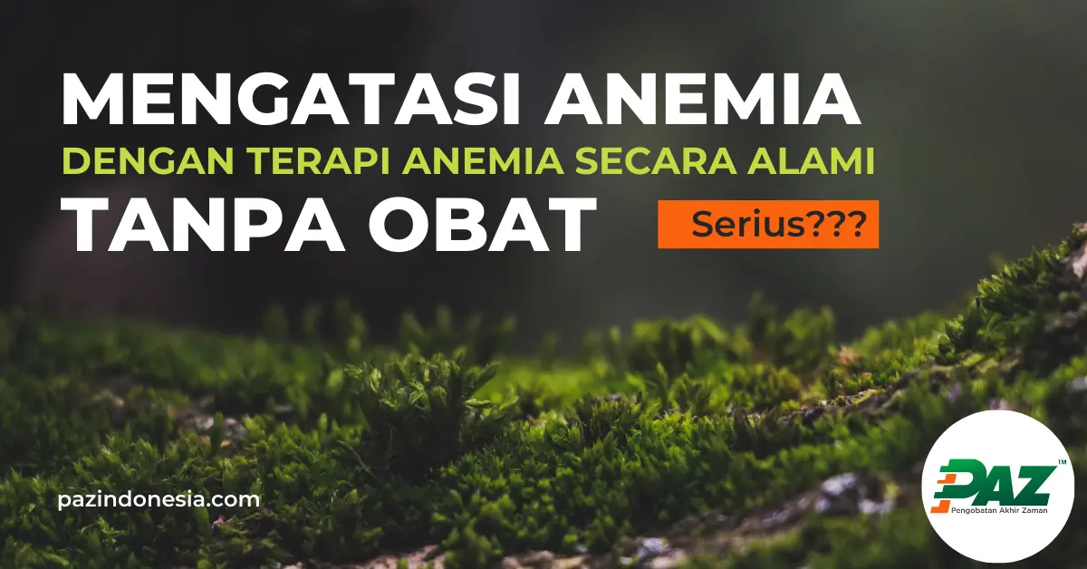 Mengatasi Anemia dengan Terapi Anemia Secara Alami Ini